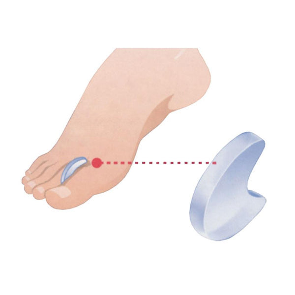 Toe Retractor Silicone - At Therapy Limited
